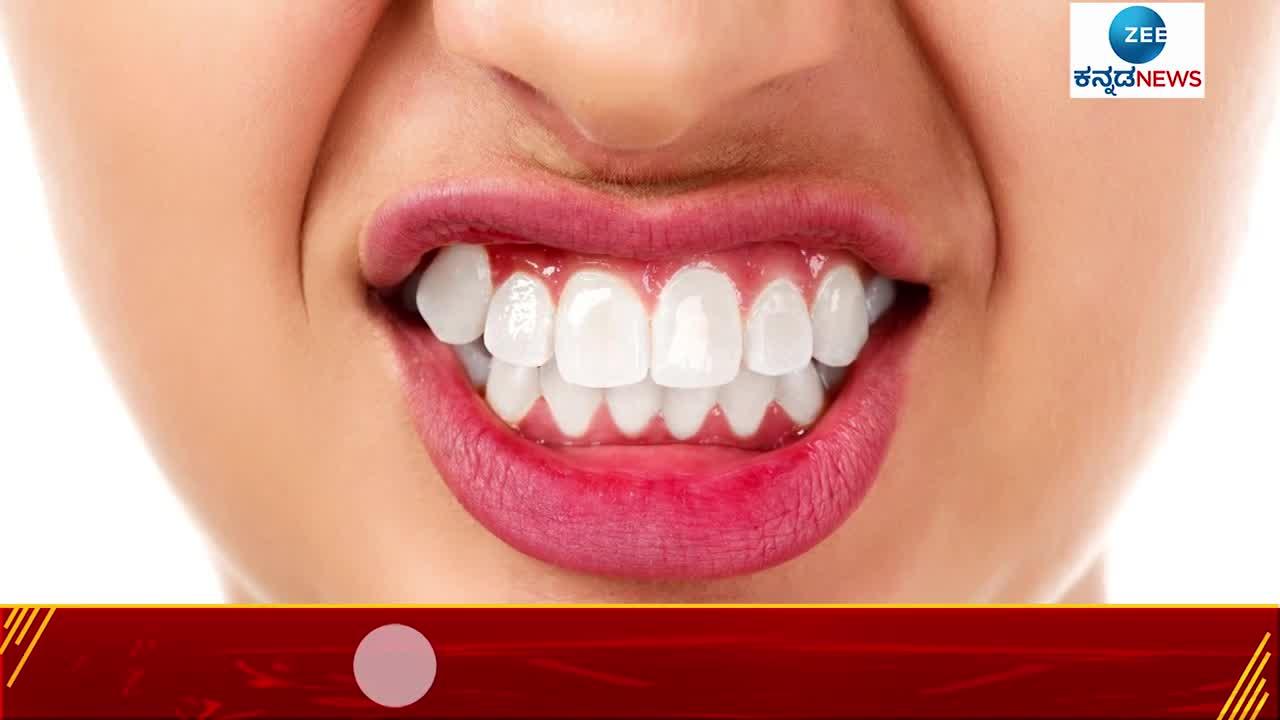 teeth whitening home remedies | ಹಲ್ಲುಗಳನ್ನು ಬೆಳ್ಳಗಾಗಿಸಲು ಸಿಂಪಲ್ ಟಿಪ್ಸ್ ...