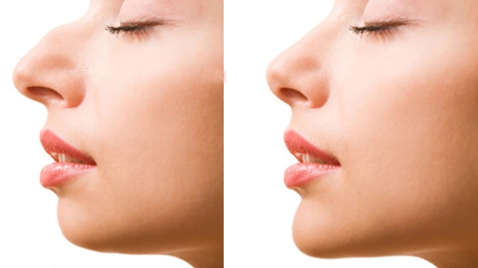 sharp nose tips exercise shaping shortening straigntening beauty care ...