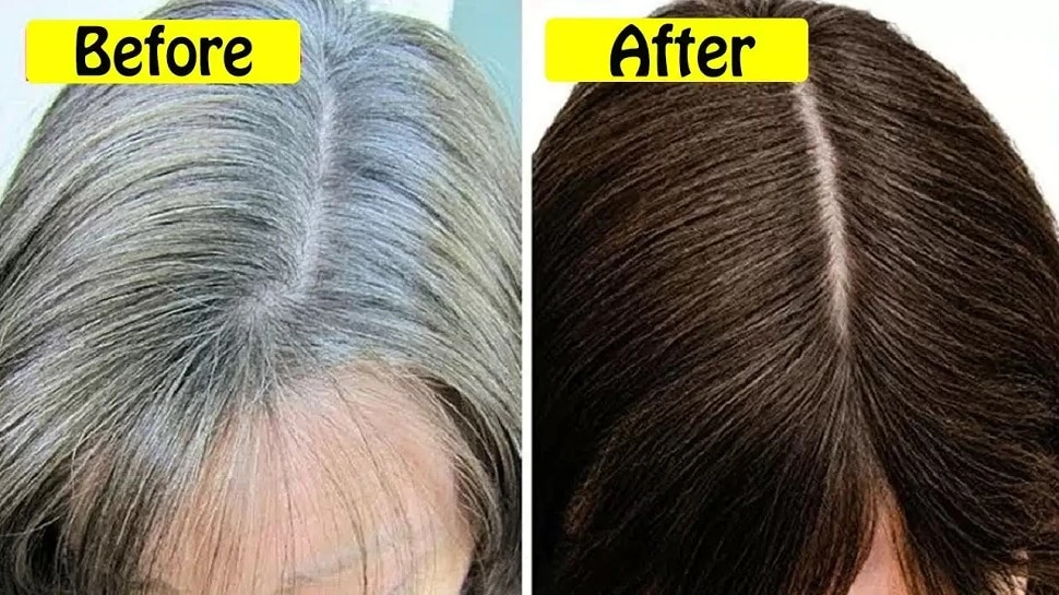 White Hair Problem in Young Age: These 5 measures will bring back black ...