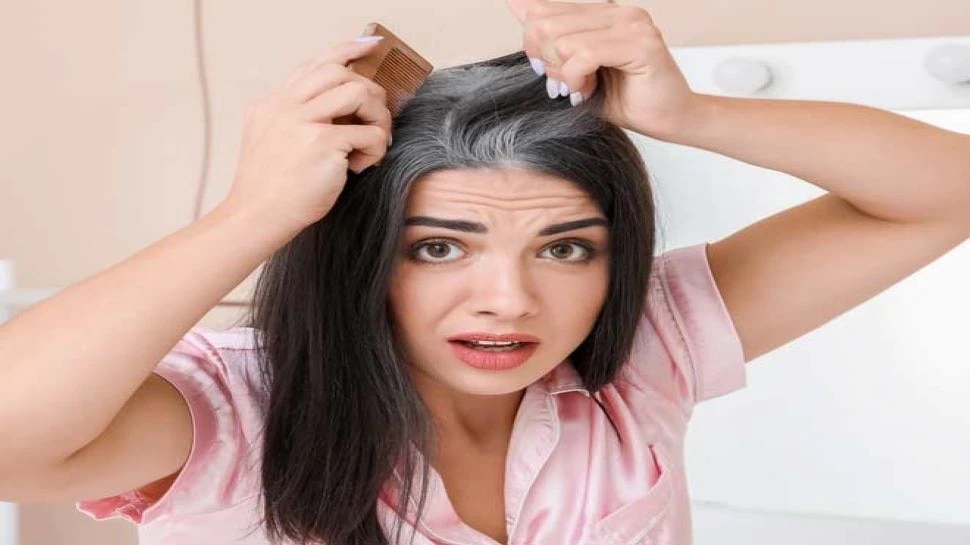 Hair Care Tips Make Hair Black With The Help Of Gooseberry ಬಿಳಿ ಕೂದಲು