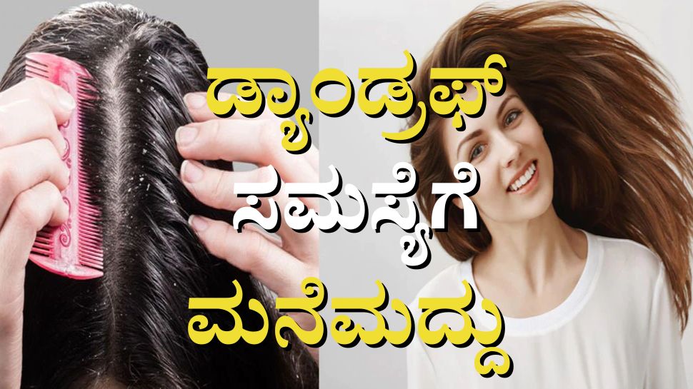 Try these home remedies to get permanent relief from dandruff problem ...