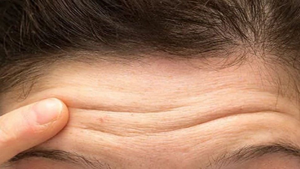 Know your age from the lines on the forehead | ಹಣೆಯ ಮೇಲಿನ ಗೆರೆಗಳಿಂದ ...