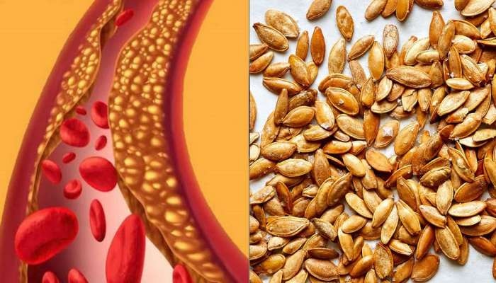 Health Care Tips how to prevent high cohlesterol pcos and thyroid and ...