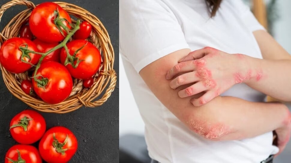 Tomato consumption causes this health problem | Tomato Side Effects ...