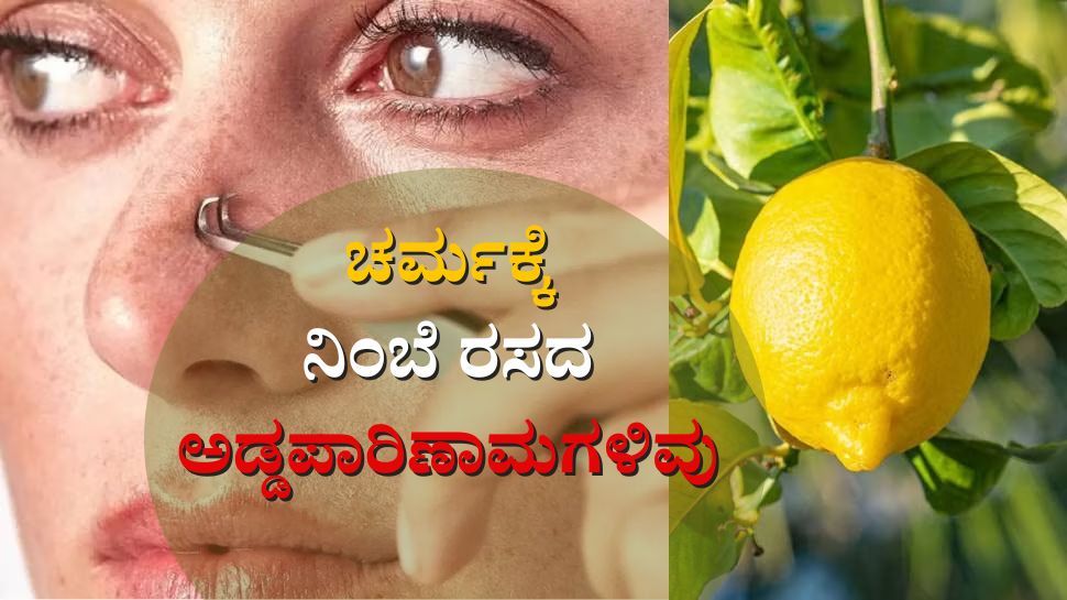 Side effects of lemon juice for skin | ಚರ್ಮಕ್ಕೆ ನಿಂಬೆ ರಸದ ...