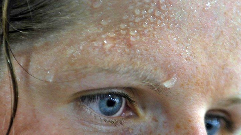 Causes of Excessive Sweating and home remedies for over sweating | ನೀವು ...