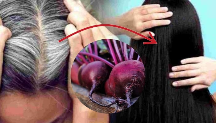 White Hair Turns Black by Beetroot hair mask | ಬಿಳಿ ಕೂದಲನ್ನು ಕಪ್ಪಾಗಿಸಲು ...