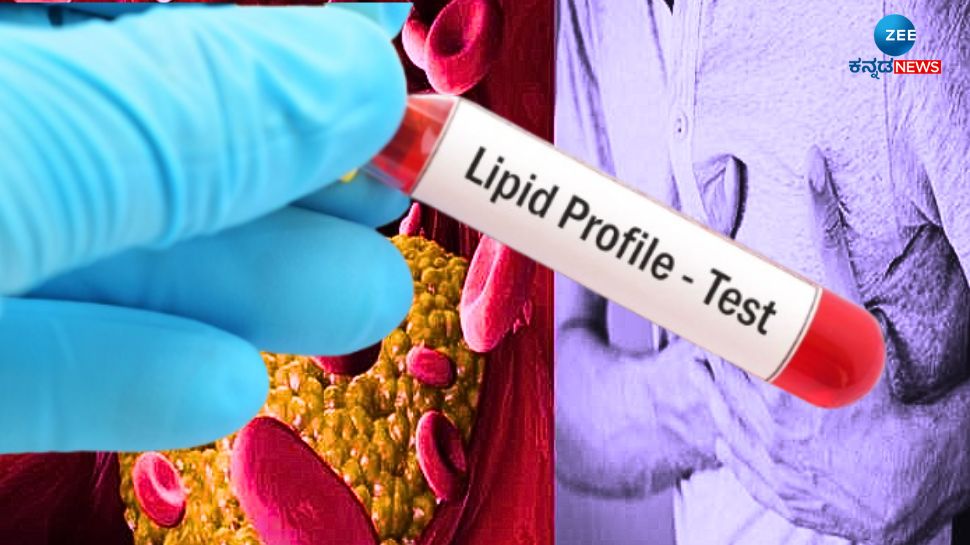 Do not make these 5 mistakes while doing lipid profile test to know ...