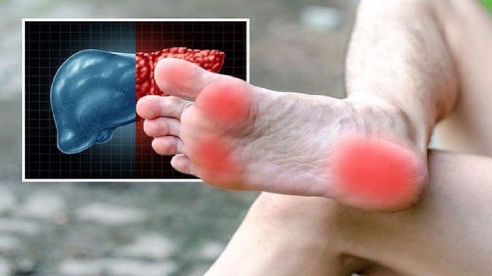 If these 3 symptoms are found under the feet it means that your liver ...