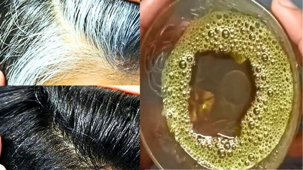 White Hair Problem: Too much White hair at a young age? Use this ...