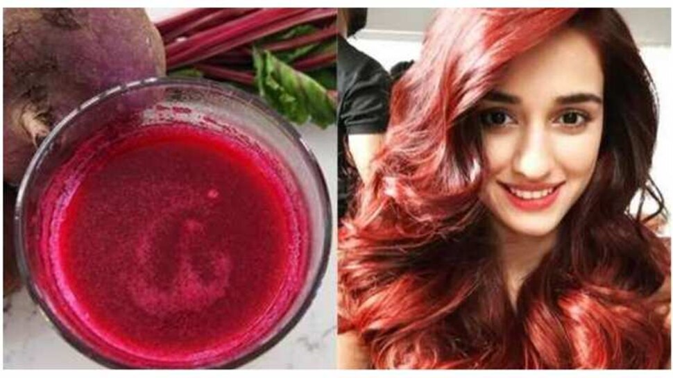 hair loss remedies Benefits Of Beetroot In Hair Loss How to use ...