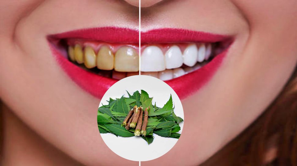 Neem Leaves For yellow teeth | ಹಳದಿ ಹಲ್ಲು ಬಿಳಿಯಾಗಿಸಲು ಮನೆಮದ್ದುHealth ...