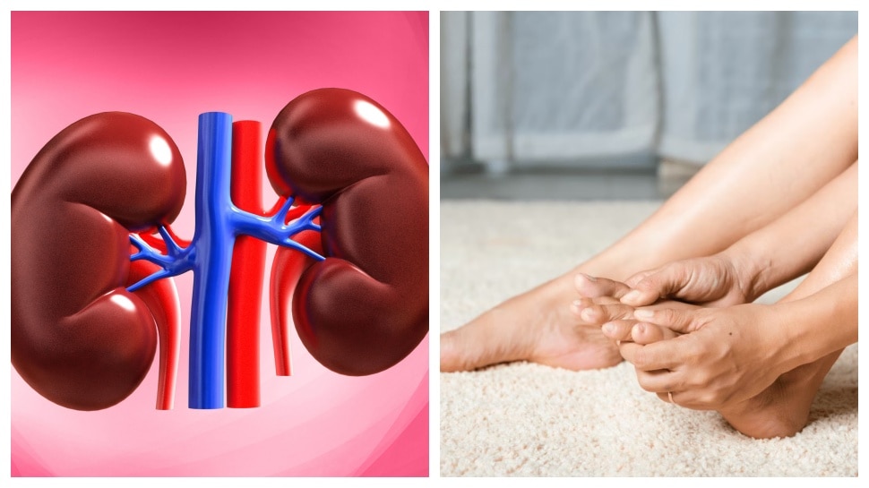 these symptoms on feet shows the problems in kidney | ಕಾಲಿನಲ್ಲಿ ಈ ...