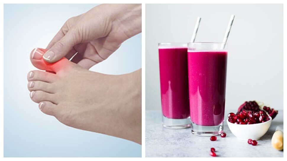 pomagranet juice to control uric acid naturally |ಕೇವಲ 10 ದಿನ ಕುಡಿದರೆ ...