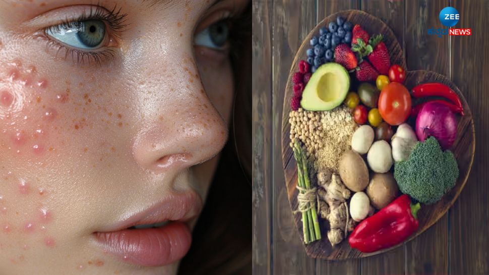 Eat these five foods in your daily diet to get permanent relief from ...
