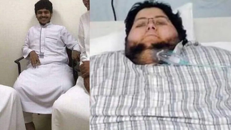 How the heaviest man Khalid bin Mohsen Shari alive lost 542 kg with the ...