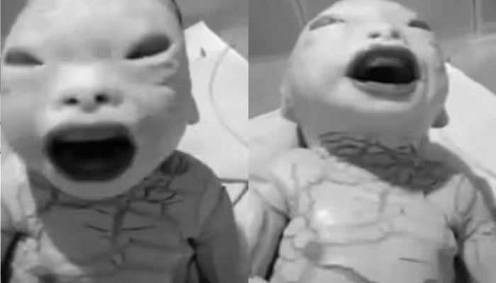 Alien Child Viral Photos | ಏಲಿಯನ್‌ ಮಗುವಿನ ಫೋಟೋ | ಏಲಿಯನ್‌ ಮಗು ನೋಡಿದ್ದೀರಾ ...