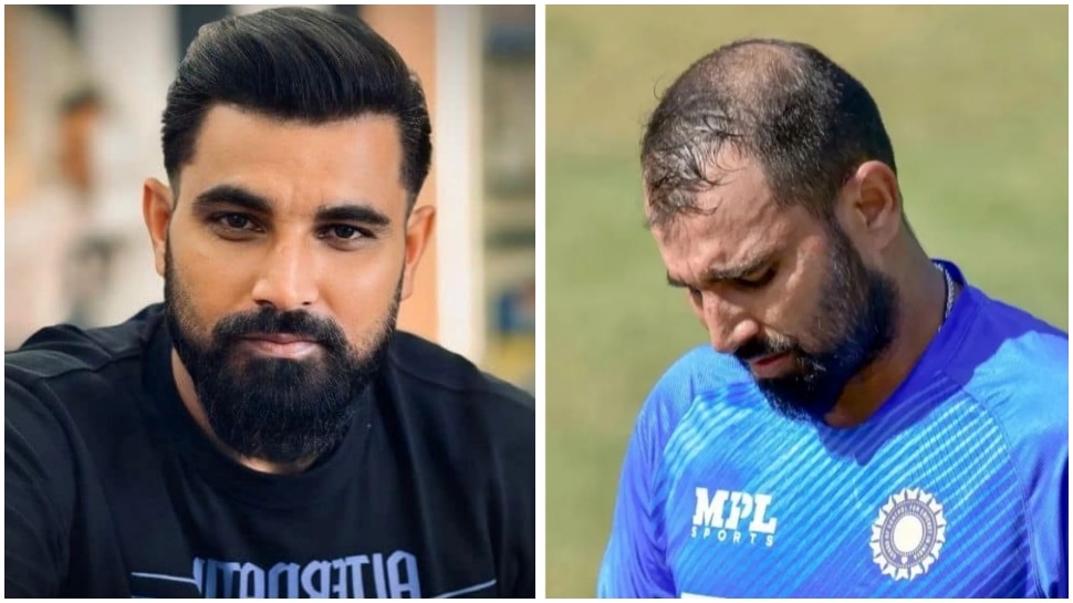 do you know What is the treatment cricketer Mohammed Shami took for ...