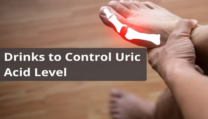 simple remedy to control uric acid and kidney stone |ಈ ಒಣಹಣ್ಣು ನೆನೆಸಿದ ...