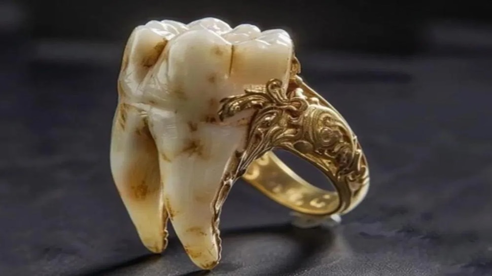 This is the world's most expensive human tooth!; Do you know what's so ...