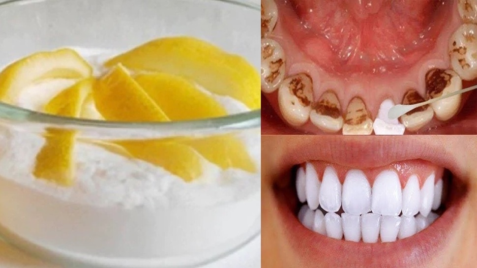 lemon peel for teeth whitening: If you brush your teeth with the peel ...