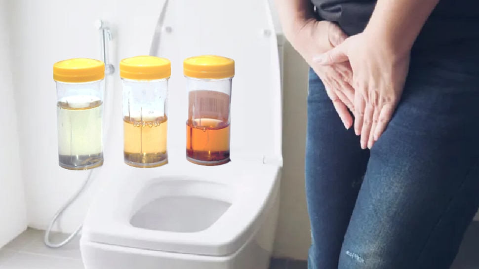What does red urine indicate? What color should your urine be? |ಮೂತ್ರದ ...