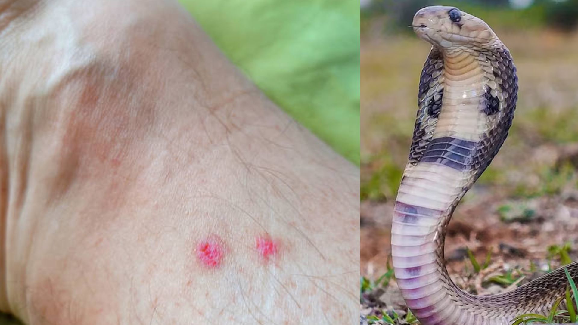 Snake Bite Remedies At Home naturally | ಹಾವು ಕಚ್ಚಿದವರ ಜೀವ ಉಳಿಸುವ ಏಕೈಕ ...