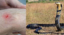 Latest Kannada News poisonous snake treatment bitter gourd benefits ...