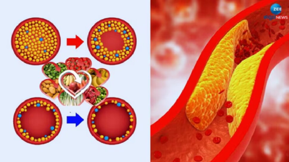 how co reduce Cholesterol: 5 superfoods will help flush out bad ...