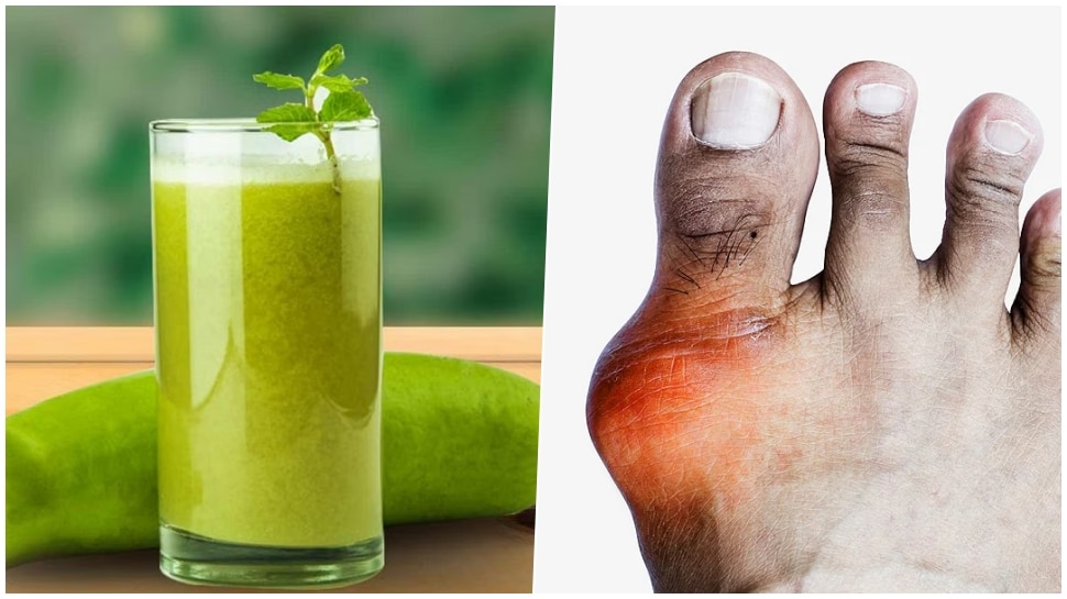 Bottle Gourd juice for uric acid in kannada | ಪ್ರತಿದಿನ ಒಂದು ಲೋಟ ಈ ...