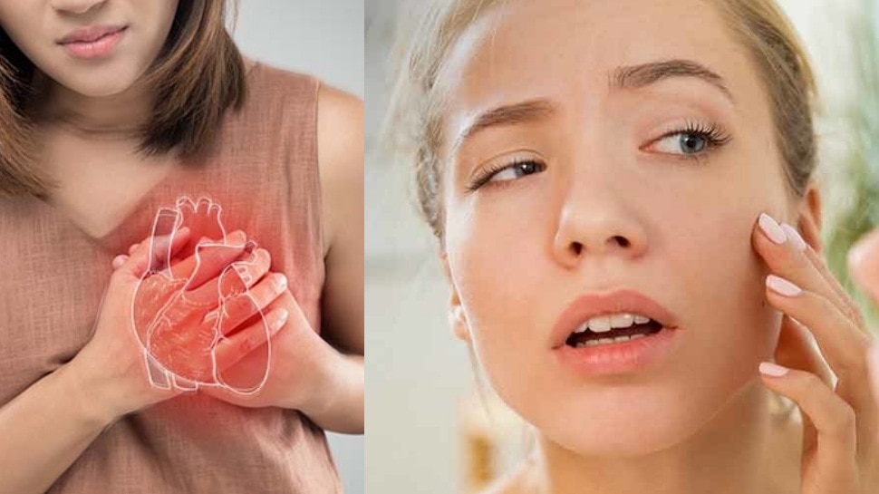 Heart attack warning signs on face : yellowish orange growths on your ...