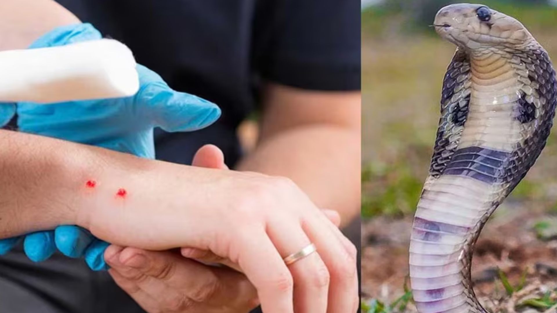 Snake Bite First Aid Treatment and natural remedy| ಹಾವು ಕಡಿತದ ನಂತರ ...