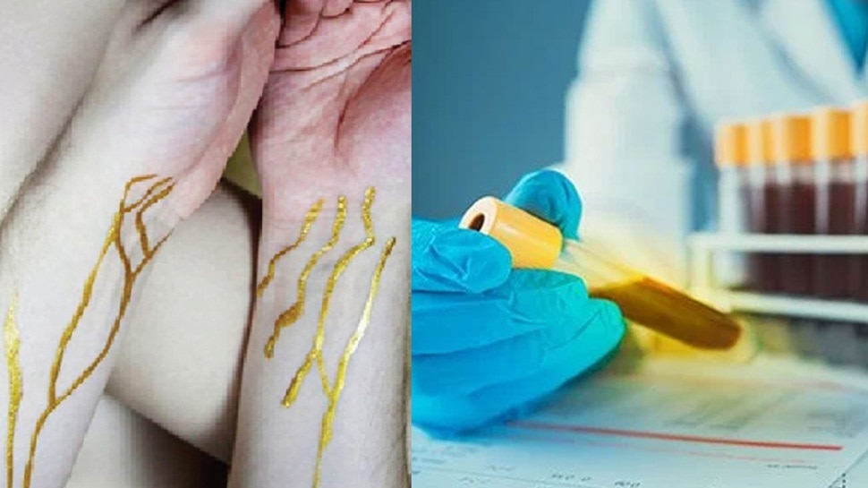 The rarest golden blood in the world: This is the blood group that ...