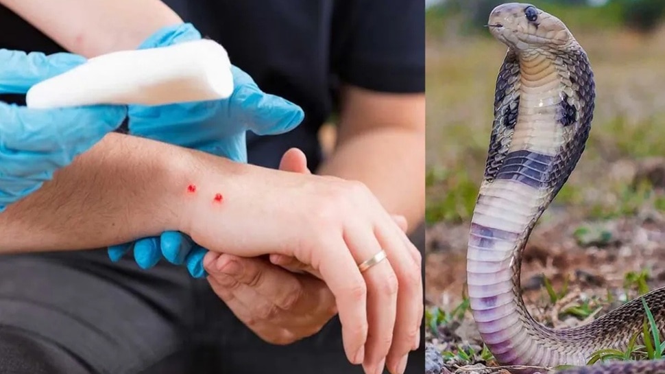 first aid for snake bites: According to WHO What to do immediately ...