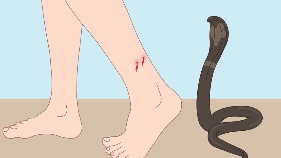 first aid for snake bites: According to WHO What to do immediately ...