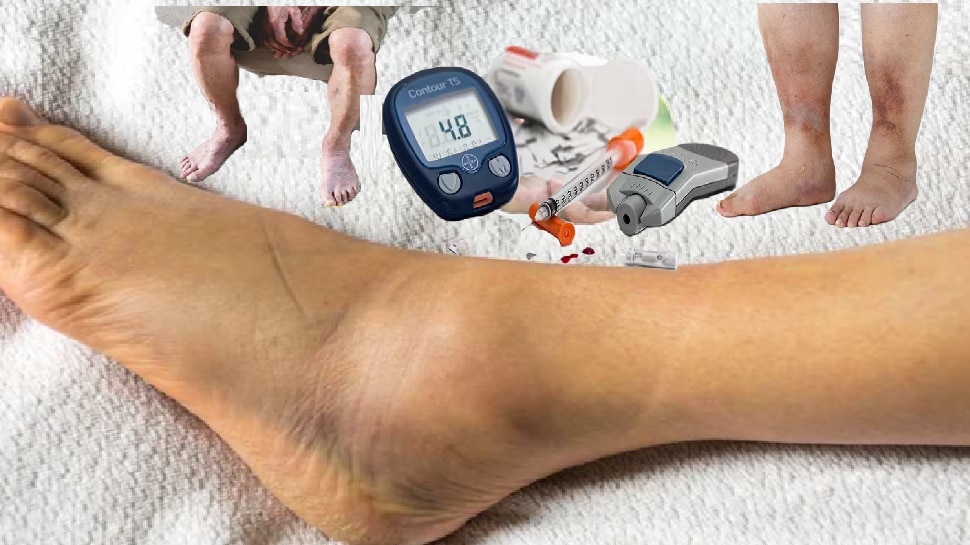 Are you also in the pre-diabetes stage? these 6 symptoms that should ...