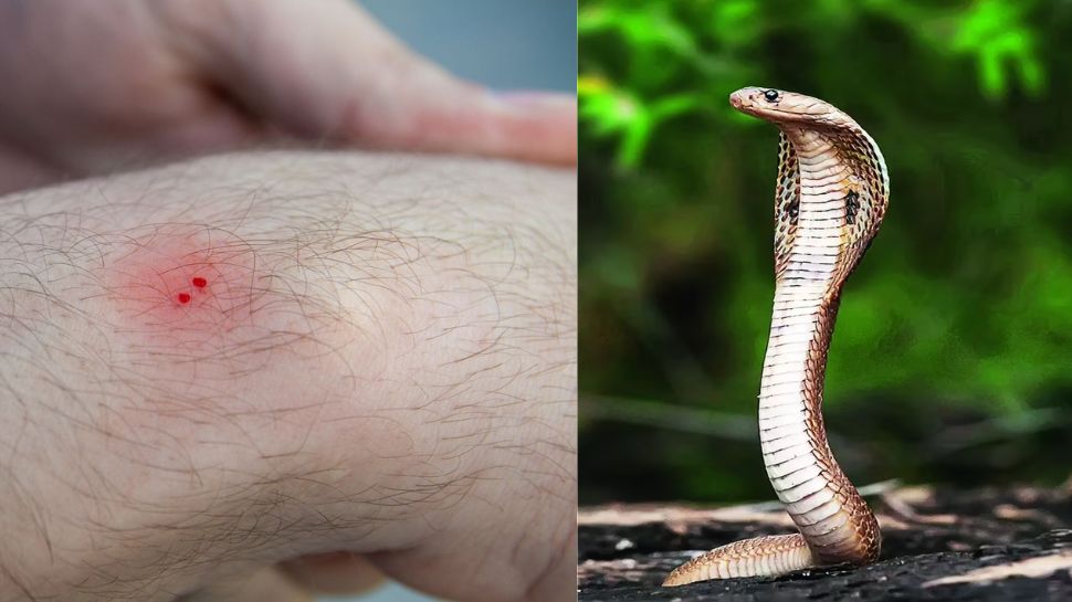 Snake Bite immediate first aid treatment to save life it works 99% ...