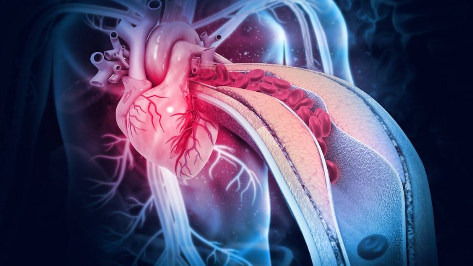 Early Heart Attack symptoms before 30 days before heart attack | ಹಾರ್ಟ್ ...