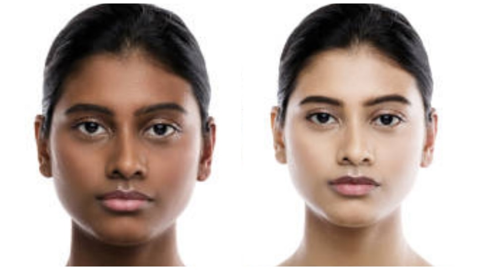 black skin to white skin treatment natural remedies | ಇತ್ತೀಚಿಗೆ ನಿಮ್ಮ ...