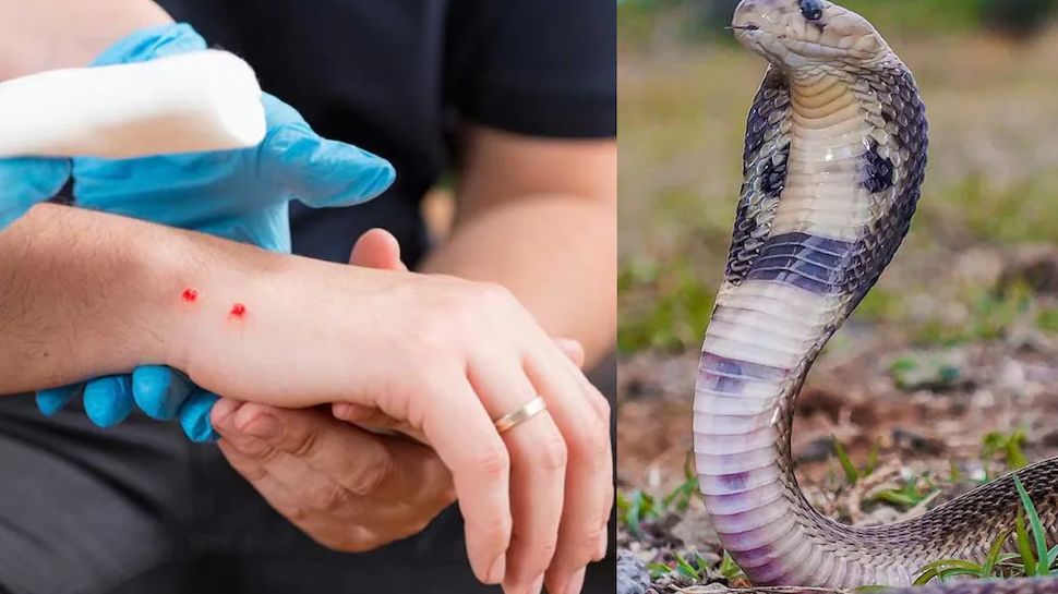 Snake Bite: Best First Aid Method to treat Snake Bite | ಎಷ್ಟೇ ವಿಷಕಾರಿ ...