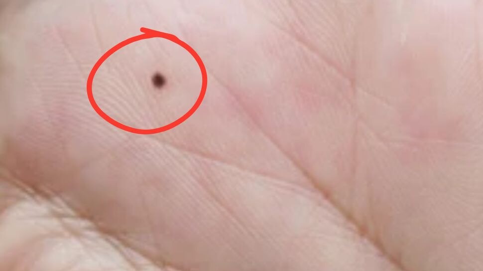 Astrology moles on body and their effects |ದೇಹದ ಈ ಭಾಗದಲ್ಲಿ ಮಚ್ಚೆ ಇದ್ರೆ ...