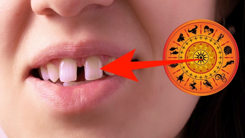 having Gap Between Teeth is lucky or unlucky as per astrology | ನಿಮ್ಮ ...