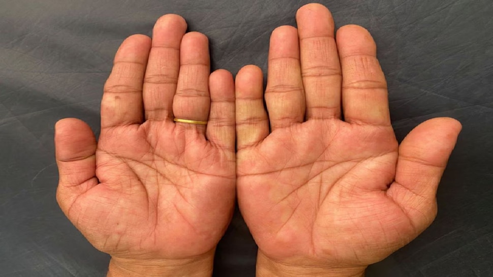These 5 Palm Symbols Can Bring Wealth and Fame Into Your Life |ಕೈಯಲ್ಲಿ ...